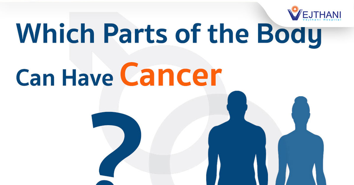 Which parts of the body can have cancer? - Life Cancer Center