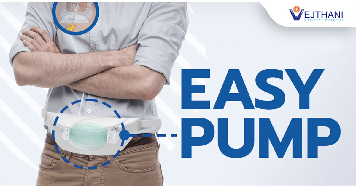 ใครบ้าง ที่สามารถให้คีโม แบบ Easy Pump ได้ - Vejthani Cancer