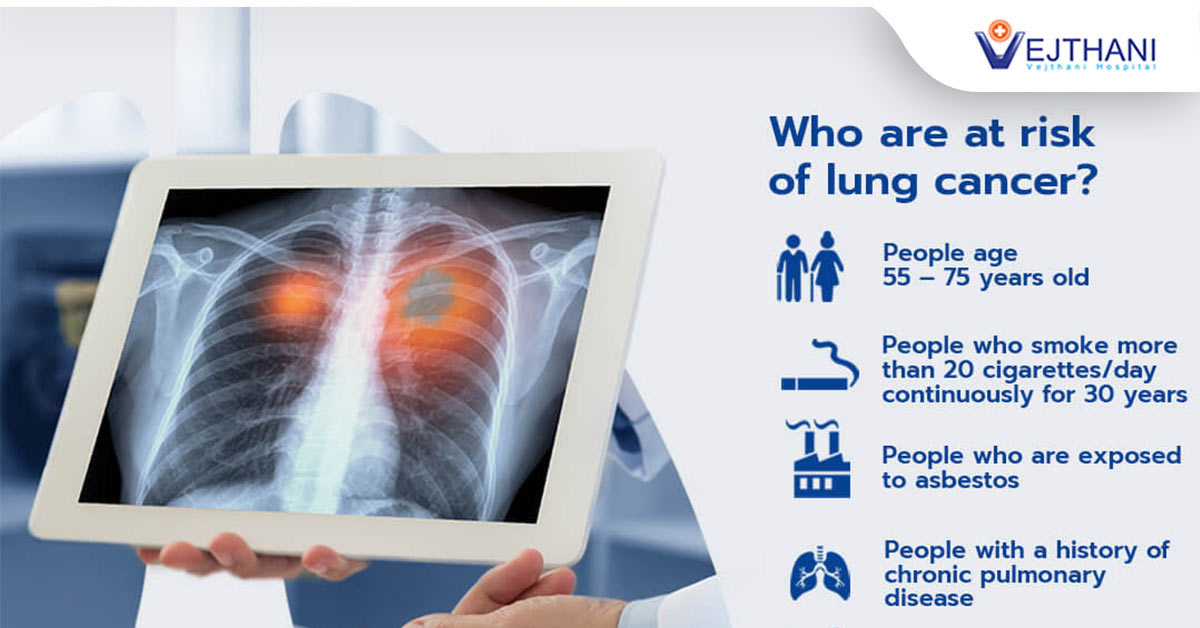 Early detection of “lung cancer” leads to a chance of survival - Life ...