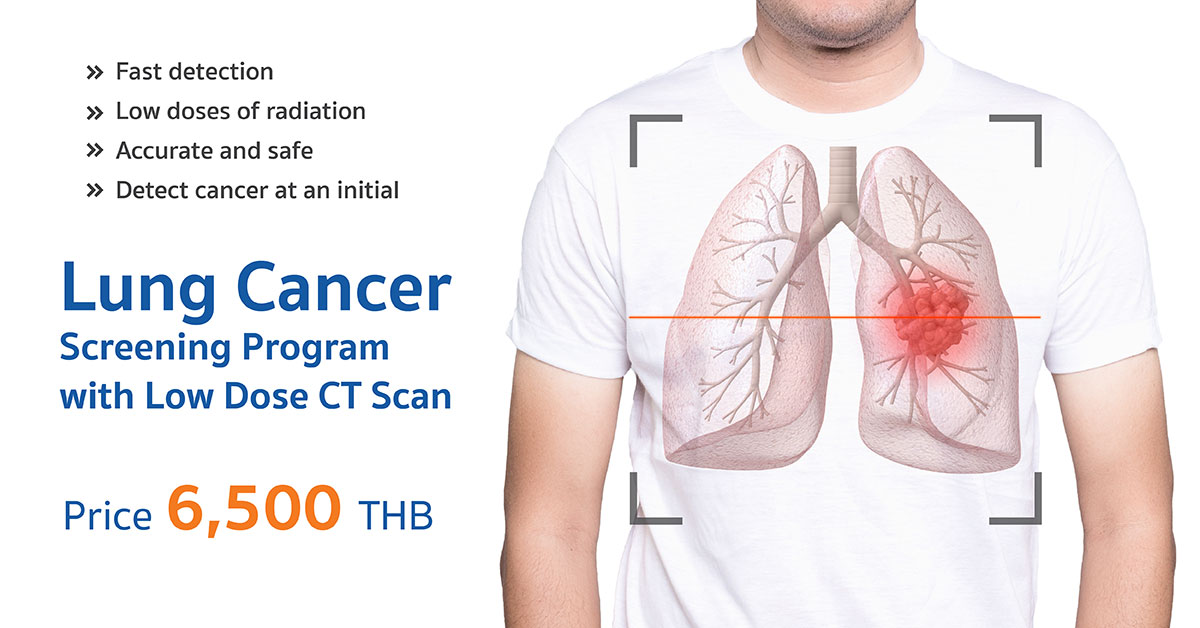 Lung Cancer Screening Program with Low Dose CT Scan - Life Cancer Center