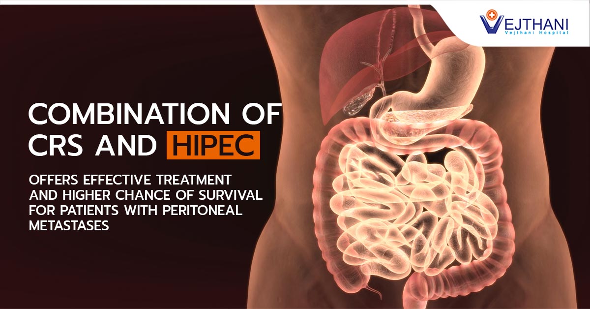 Combination of CRS and HIPEC offers Effective Treatment and Higher ...