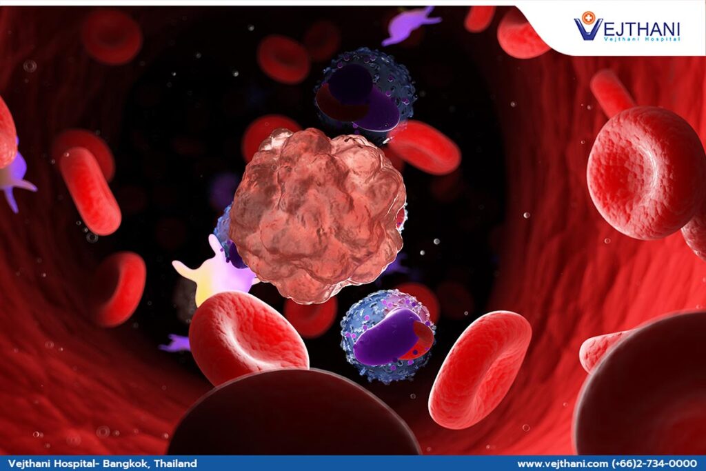 Acute Myeloid Leukemia - Life Cancer Center