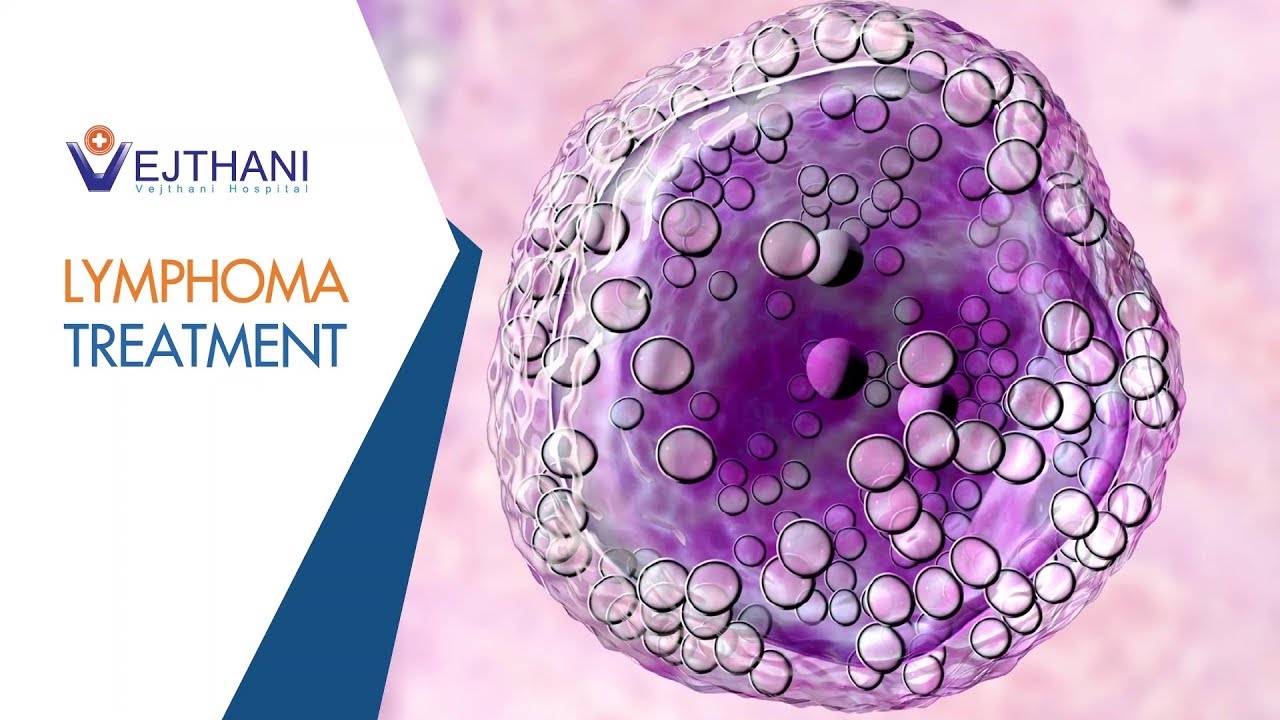 Lymphoma Treatment - Life Cancer Center